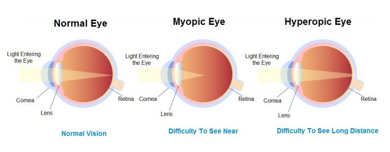 Eye Number Test | Vision Test | Eye Glasses | Eye Specialist in Pune